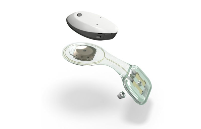 Osia de Cochlear supporte désormais les IRM à 3 Tesla - L'Ouïe Magazine