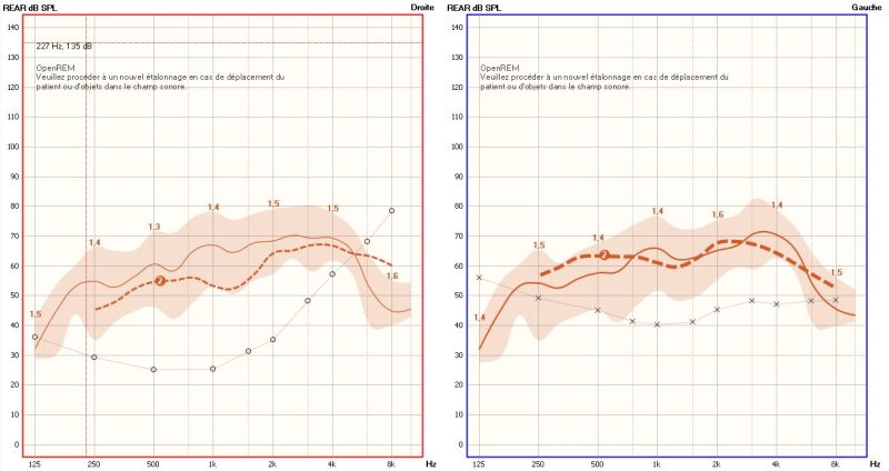 Un audioprothésiste a soumis les lunettes Nuance Audio à un 1er crash ...