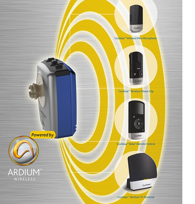 Baha® 4, nouvelle solution évolutive de Cochlear™ - L'Ouïe MagazineL ...